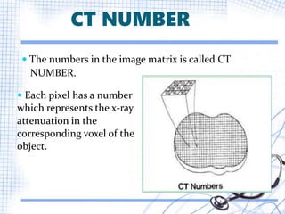 Computed Tomography and Spiral Computed Tomography | PPTX