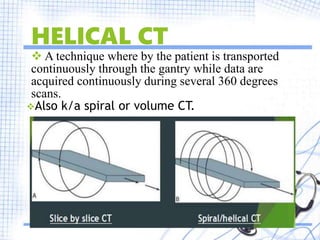 Computed Tomography and Spiral Computed Tomography | PPTX