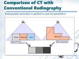 Computed Tomography and Spiral Computed Tomography | PPTX
