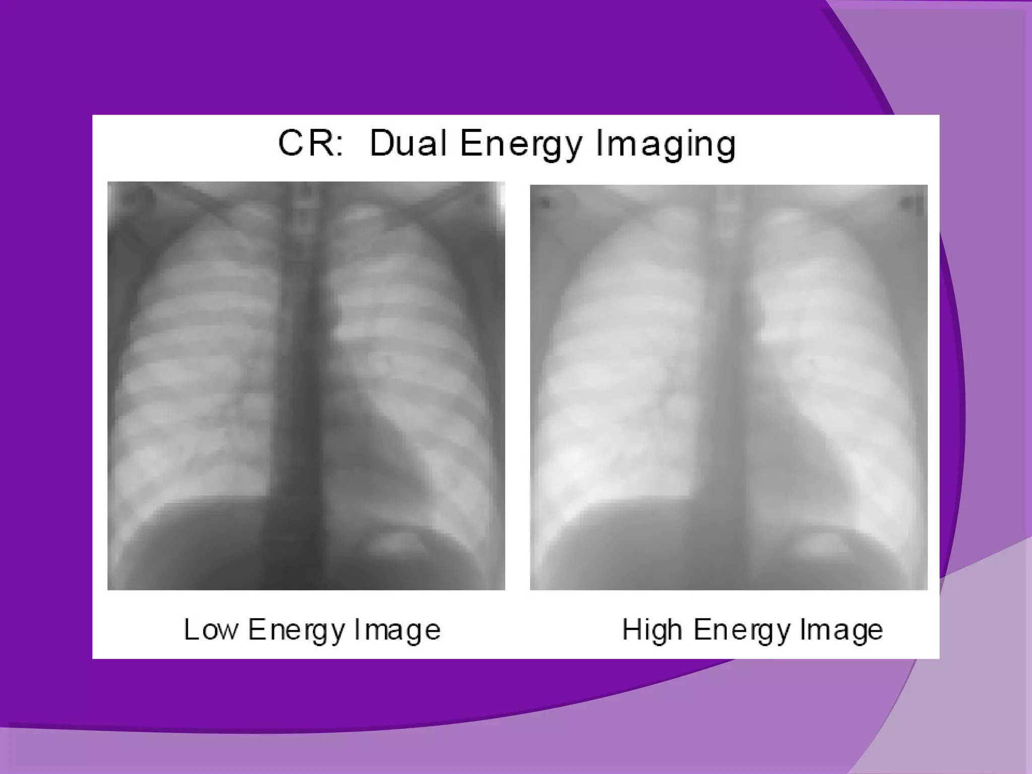 Computed radiography | PPT