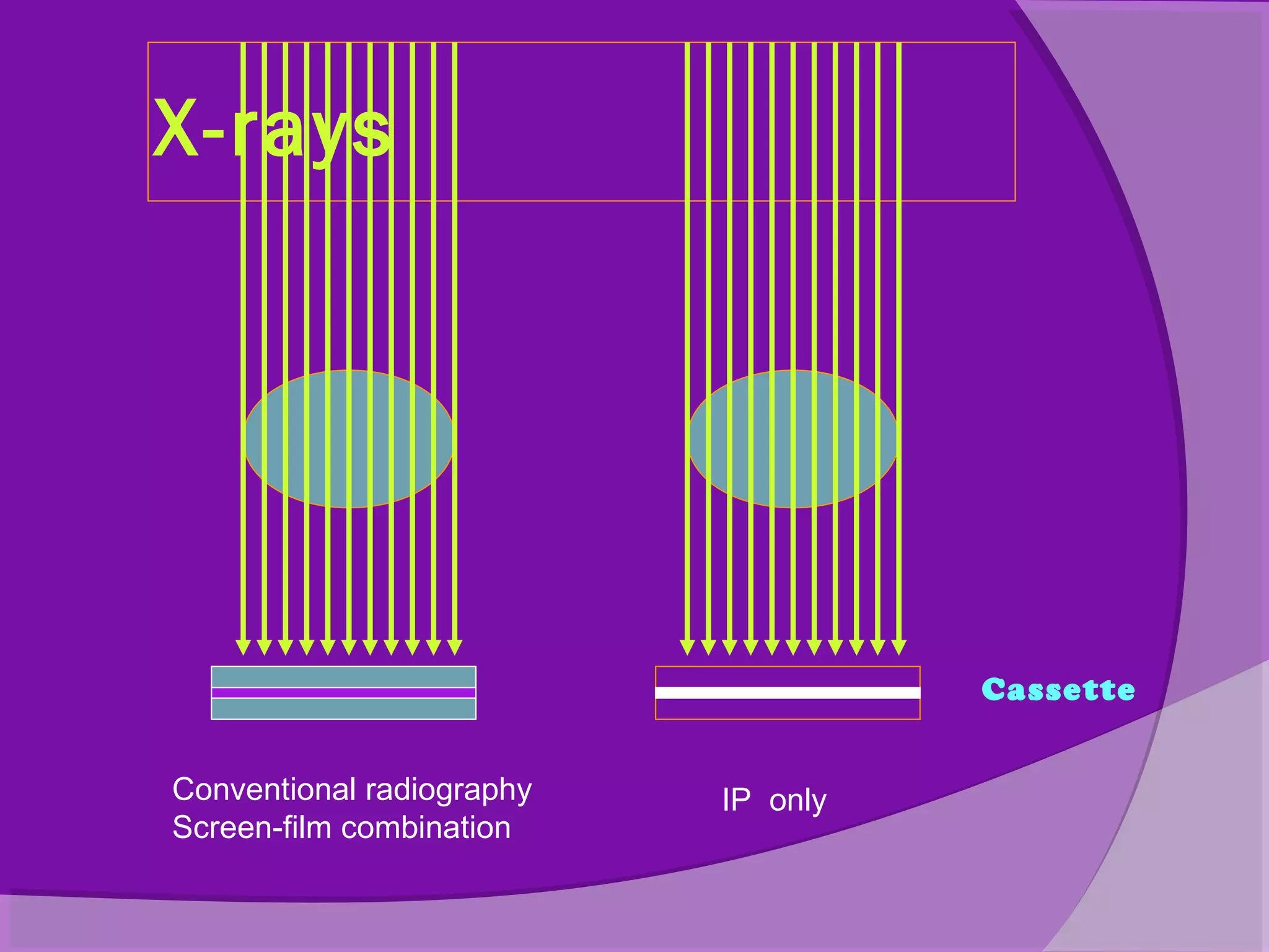 Computed radiography | PPT