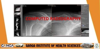 COMPUTED RADIOGRAPHY/(CR) SLIDE SHARE PPTX.. | PPTX