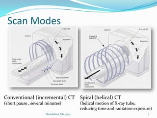 Alla Shorokhova, "COMPUTED TOMOGRAPHY" | PPTX