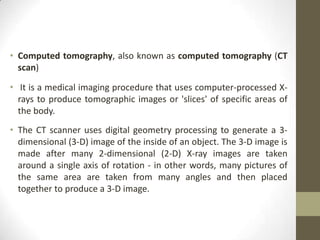 Computed tomography | PPTX