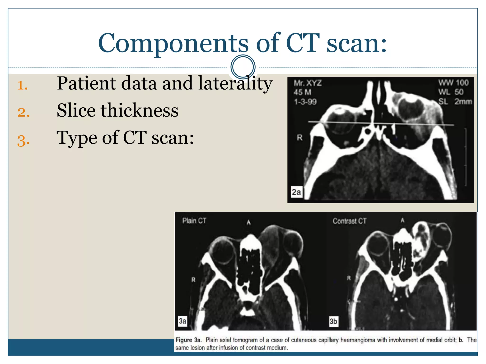 Computed tomography | PPT