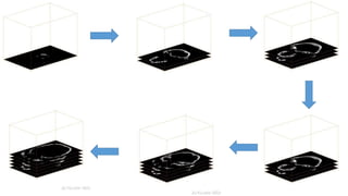 Computed Tomography (ct),CT scan NDT | PPTX