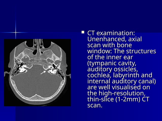 Computed Tomography in oral and maxillofacial surgery.ppt