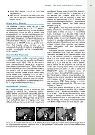 Computed tomography angiography of the hepatic, pancreatic, and ...