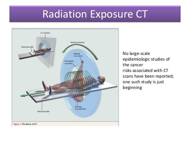 Computed tomography - radiation exposure