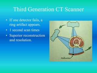 Computed tomography basics | PPTX