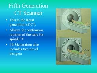 Computed tomography basics | PPTX
