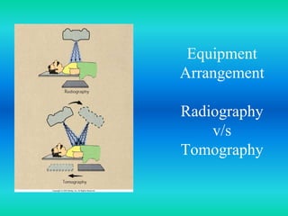 Computed tomography basics | PPTX