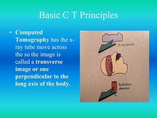 Computed tomography basics | PPTX