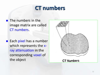Computed tomography by jay&jay | PPTX