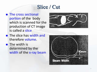 Computed tomography by jay&jay | PPTX