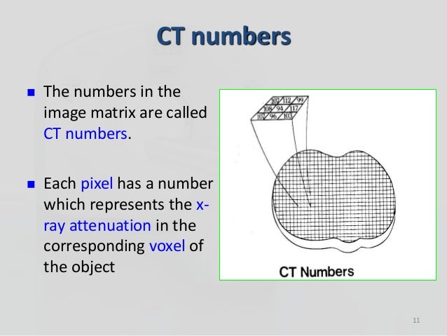 Computed tomography by jay&jay
