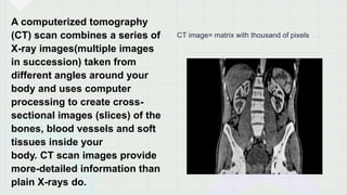 Computed Tomography final copy.pptx