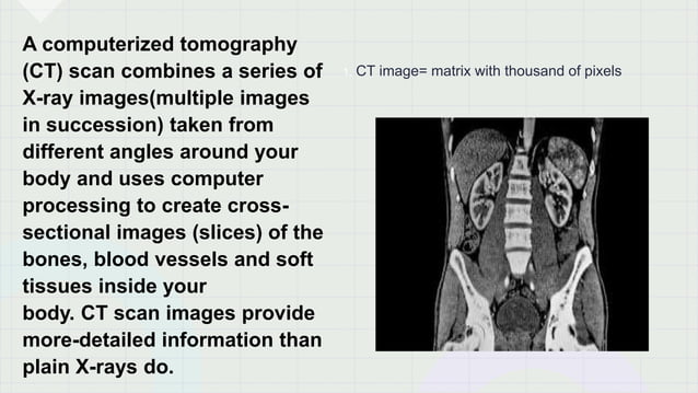 Computed Tomography final copy.pptx