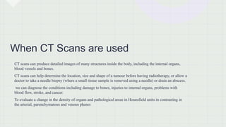 Computed Tomography final copy.pptx