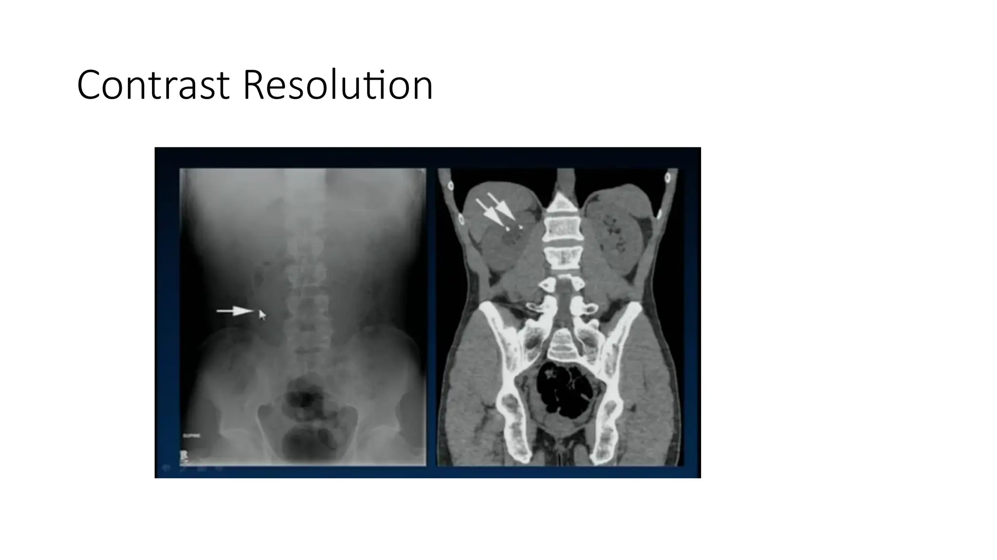 CT image quality and factors affecting it by T.R.B. | PPTX | Cameras ...