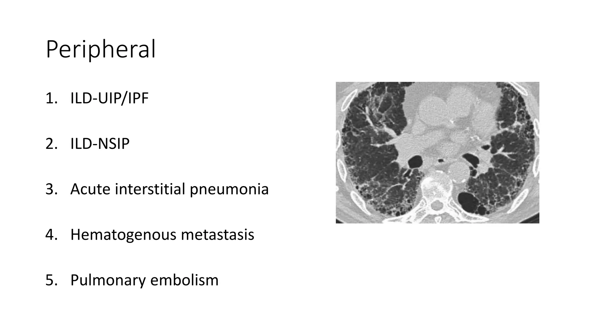 Computed tomography of thorax basics and its interpretation (1) | PPTX