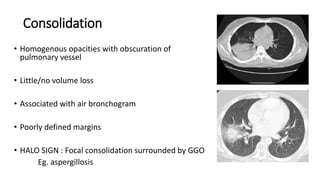 Computed tomography of thorax basics and its interpretation (1) | PPTX