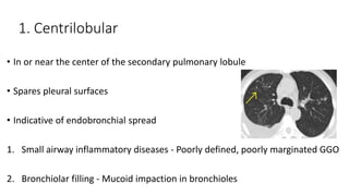 Computed tomography of thorax basics and its interpretation (1) | PPTX