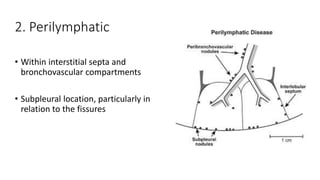 Computed tomography of thorax basics and its interpretation (1) | PPTX