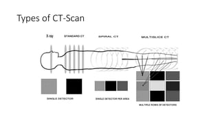 Computed tomography of thorax basics and its interpretation (1) | PPTX