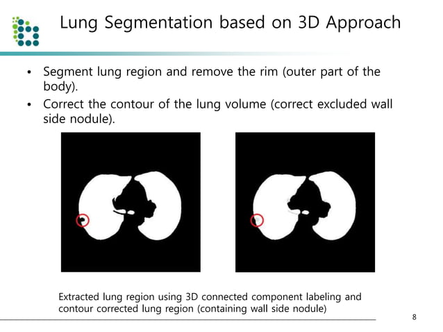 Computer Aided Detection Of Pulmonary Nodules Using Genetic Programming