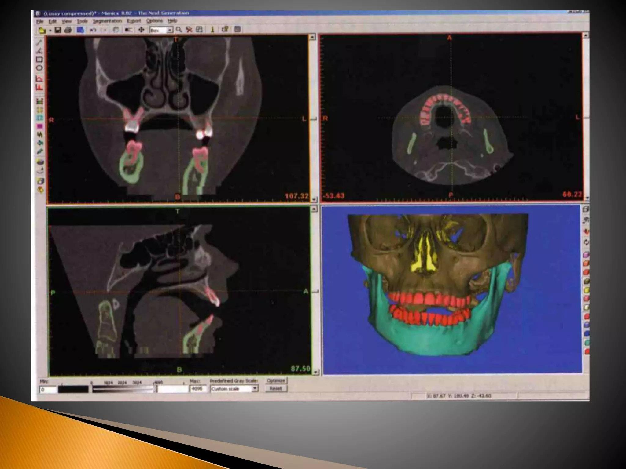 Computer in orthodontics | PPTX