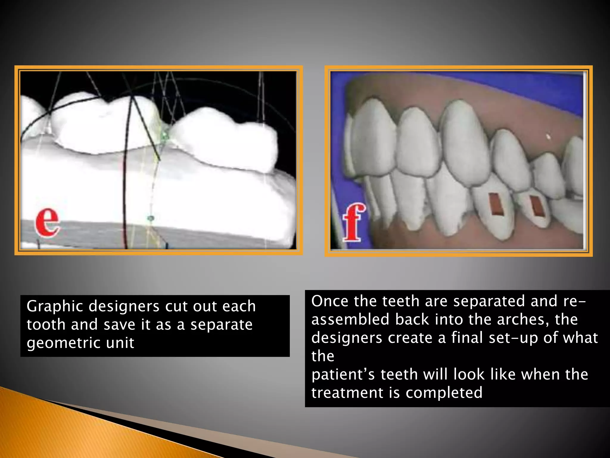 Computer in orthodontics | PPTX