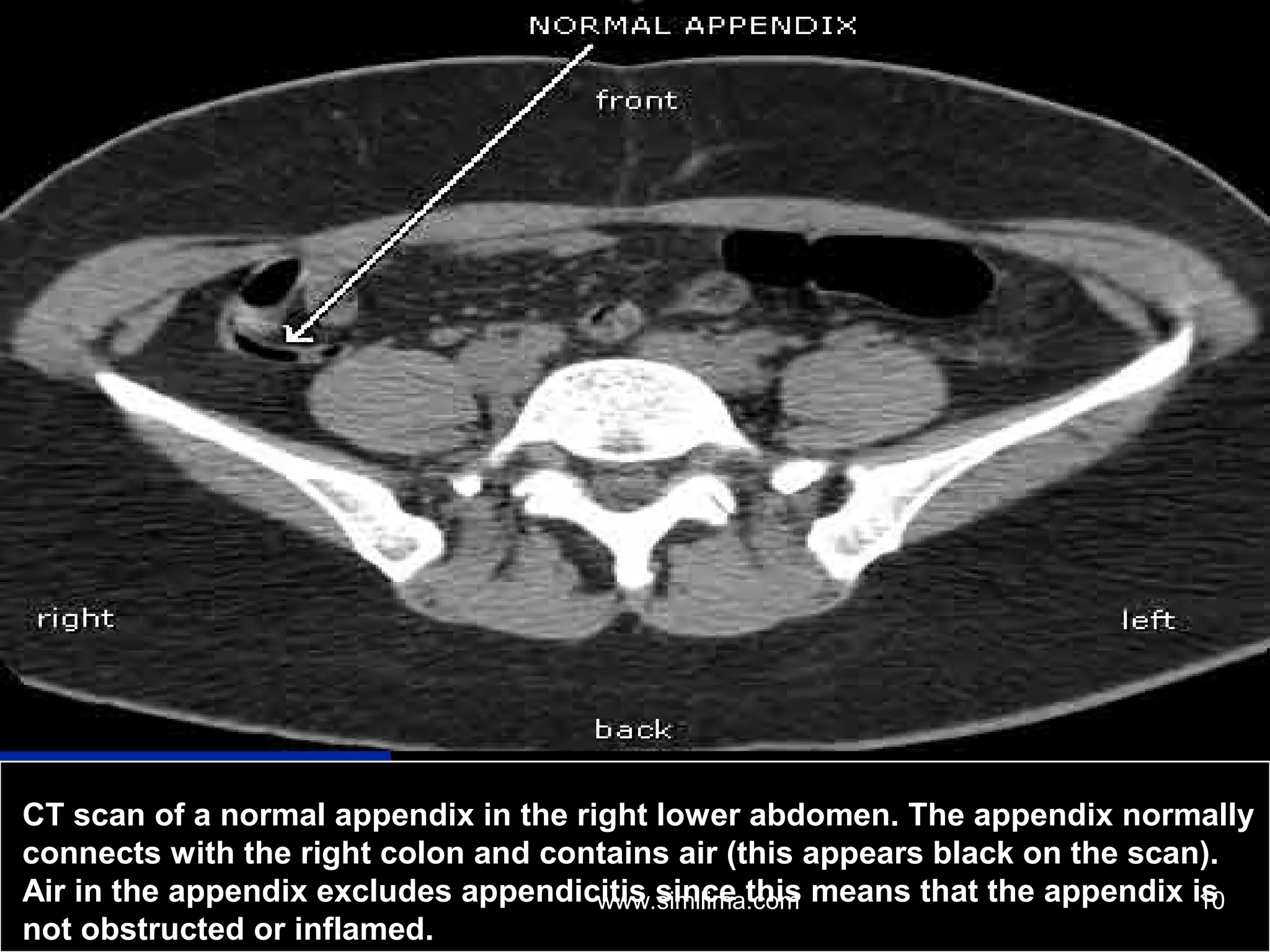 computerised-tomo-mri Computerized Tomography (CT) and Magnetic ...