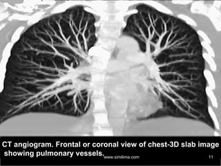 computerised-tomo-mri Computerized Tomography (CT) and Magnetic ...