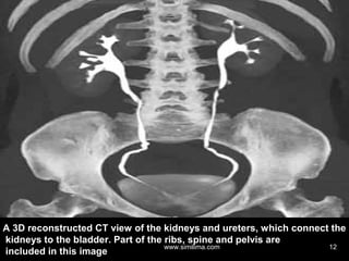 computerised-tomo-mri Computerized Tomography (CT) and Magnetic ...