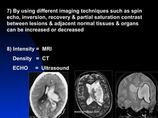 computerised-tomo-mri Computerized Tomography (CT) and Magnetic ...