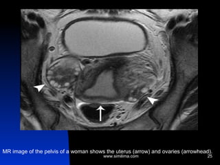computerised-tomo-mri Computerized Tomography (CT) and Magnetic ...