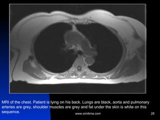 computerised-tomo-mri Computerized Tomography (CT) and Magnetic ...