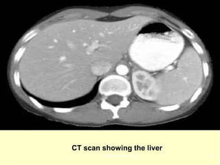 computerised-tomo-mri Computerized Tomography (CT) and Magnetic ...