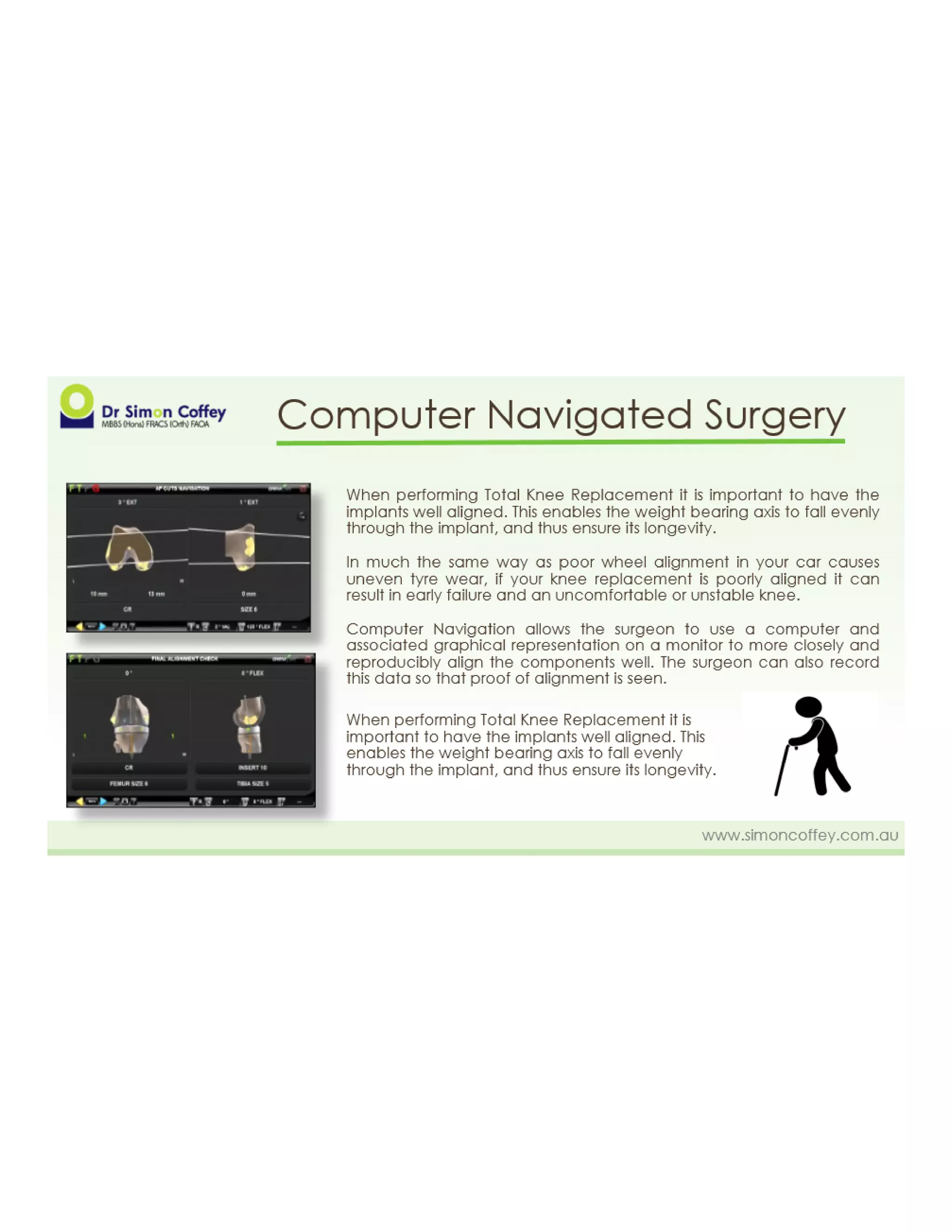 Computer Navigated Surgery | PDF