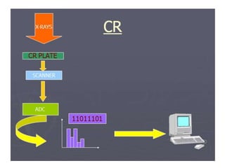 Computer radiography and digital radiography | PPTX