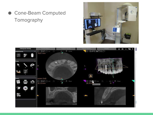 Computers in dentistry | PPTX | Dental Health | Diseases and Conditions