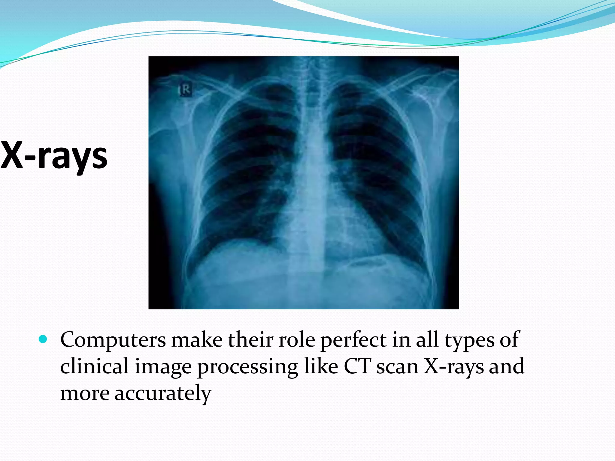 Computers in Medical field | PPTX