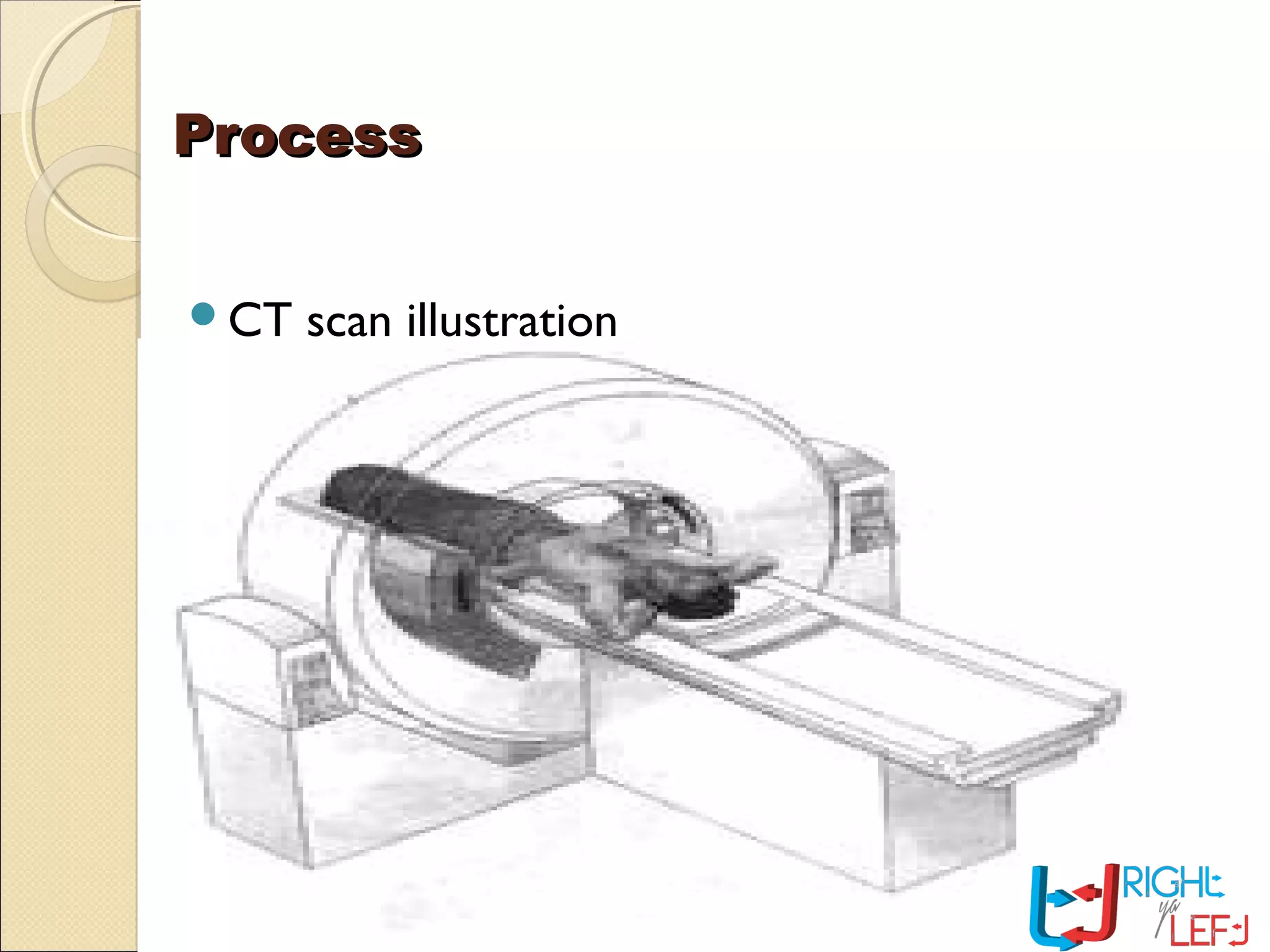 Computer Tomography (CT Scan) | PPT