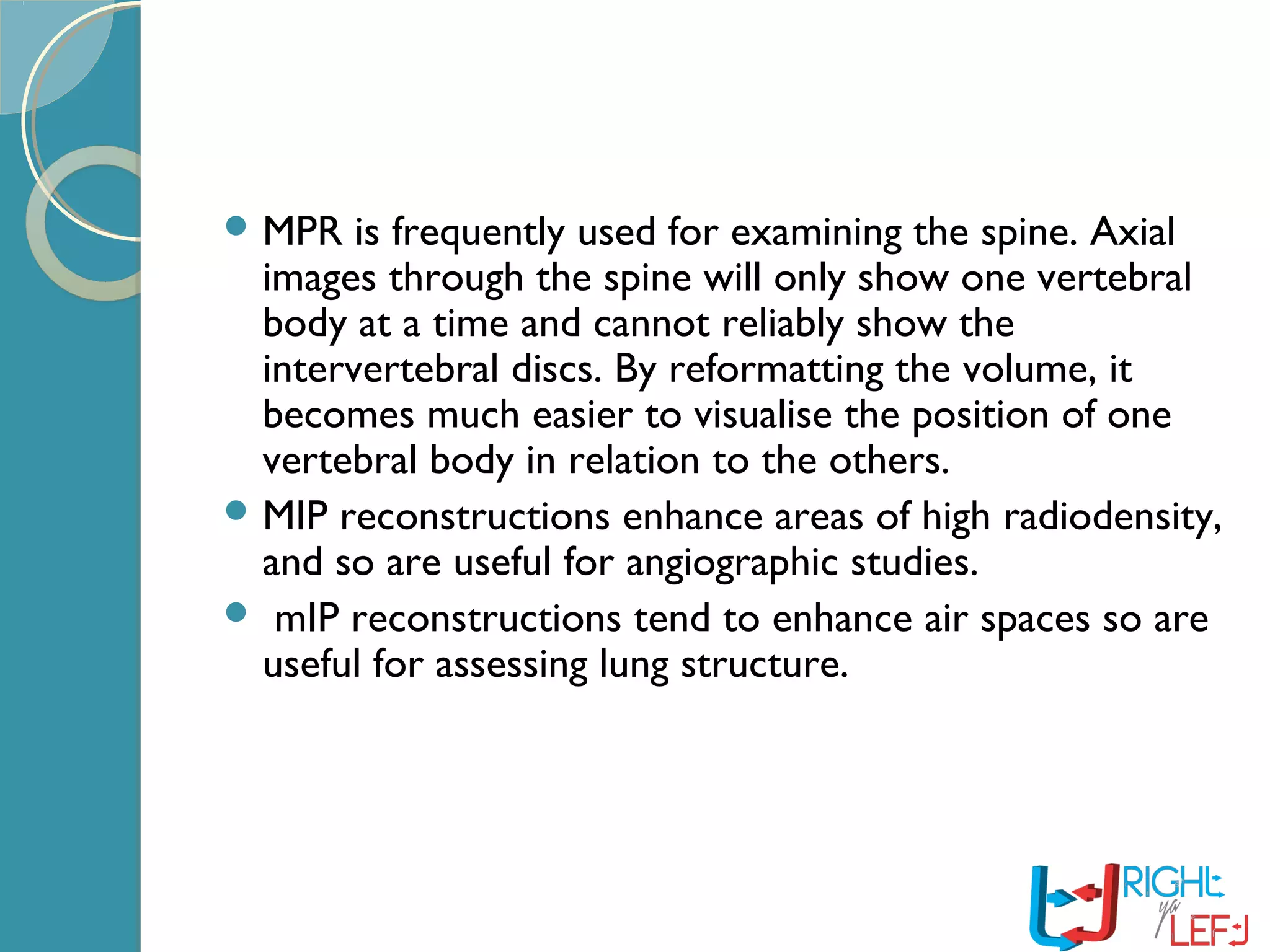 Computer Tomography (CT Scan) | PPT