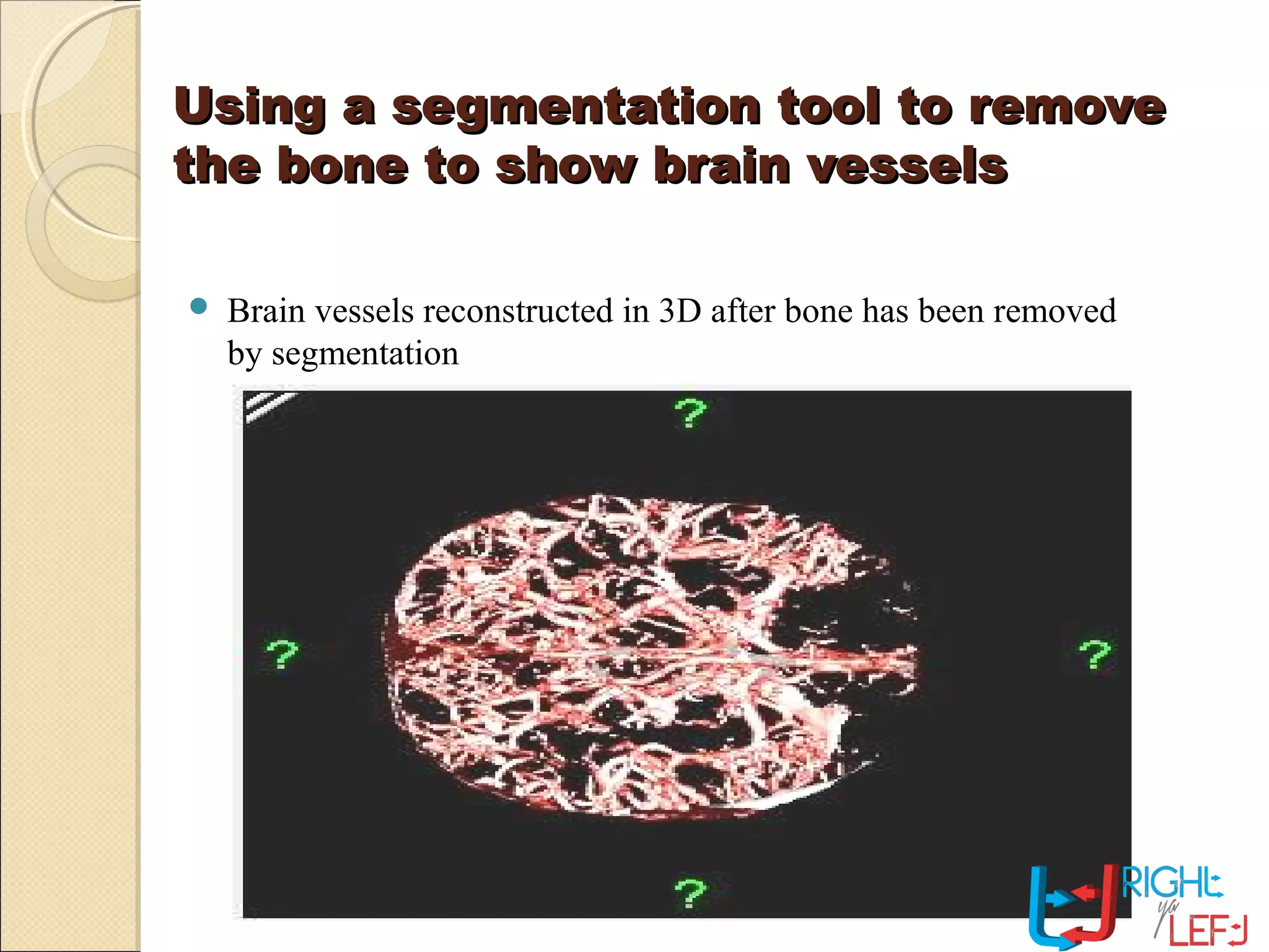 Computer Tomography (CT Scan) | PPT