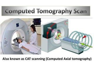 BASICS OF WORKING OF COMPUTER TOMOGRAPHY | PDF | Medical Tests ...