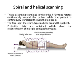 BASICS OF WORKING OF COMPUTER TOMOGRAPHY | PDF | Medical Tests ...