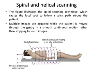 BASICS OF WORKING OF COMPUTER TOMOGRAPHY | PDF | Medical Tests ...