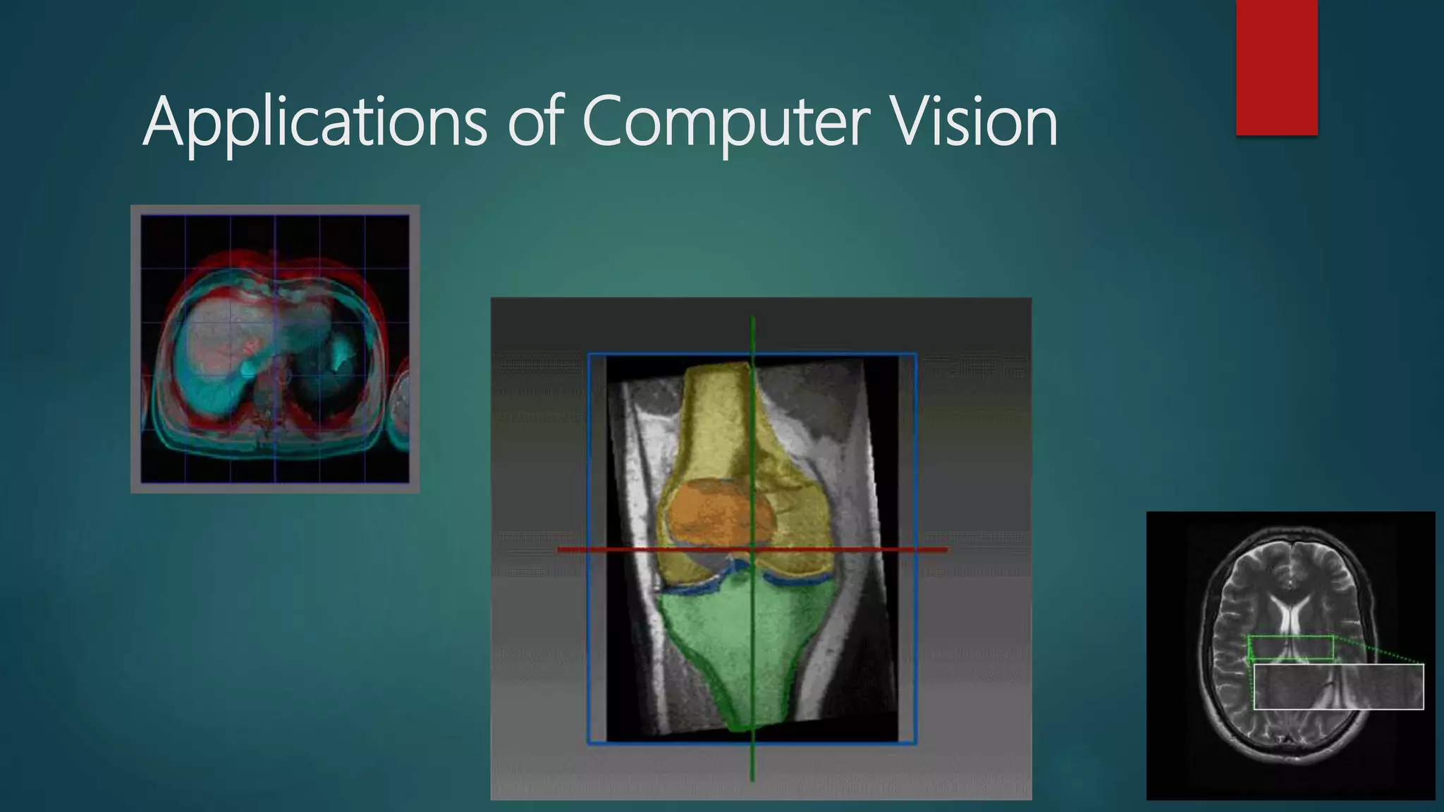 Computer vision ppt | PPTX | Artificial Intelligence | Technology & Computing